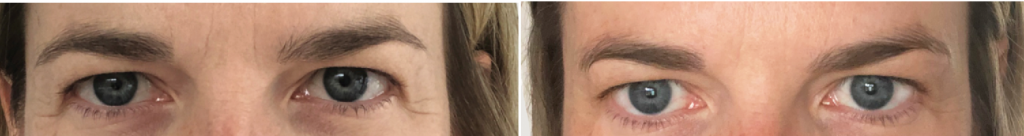 SENSSE LED Face Mask – The must have age defying device