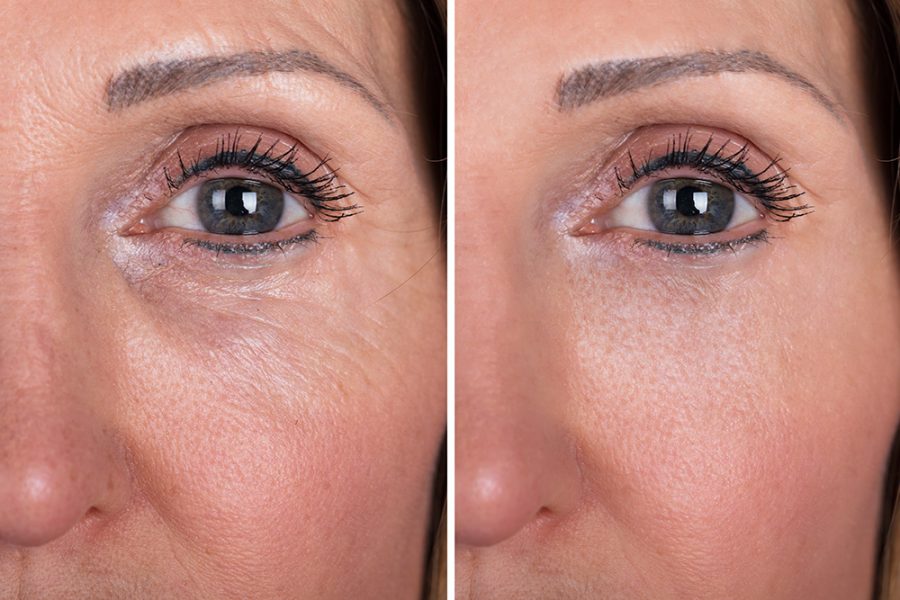 SENSSE LED Face Mask – The must have age defying device